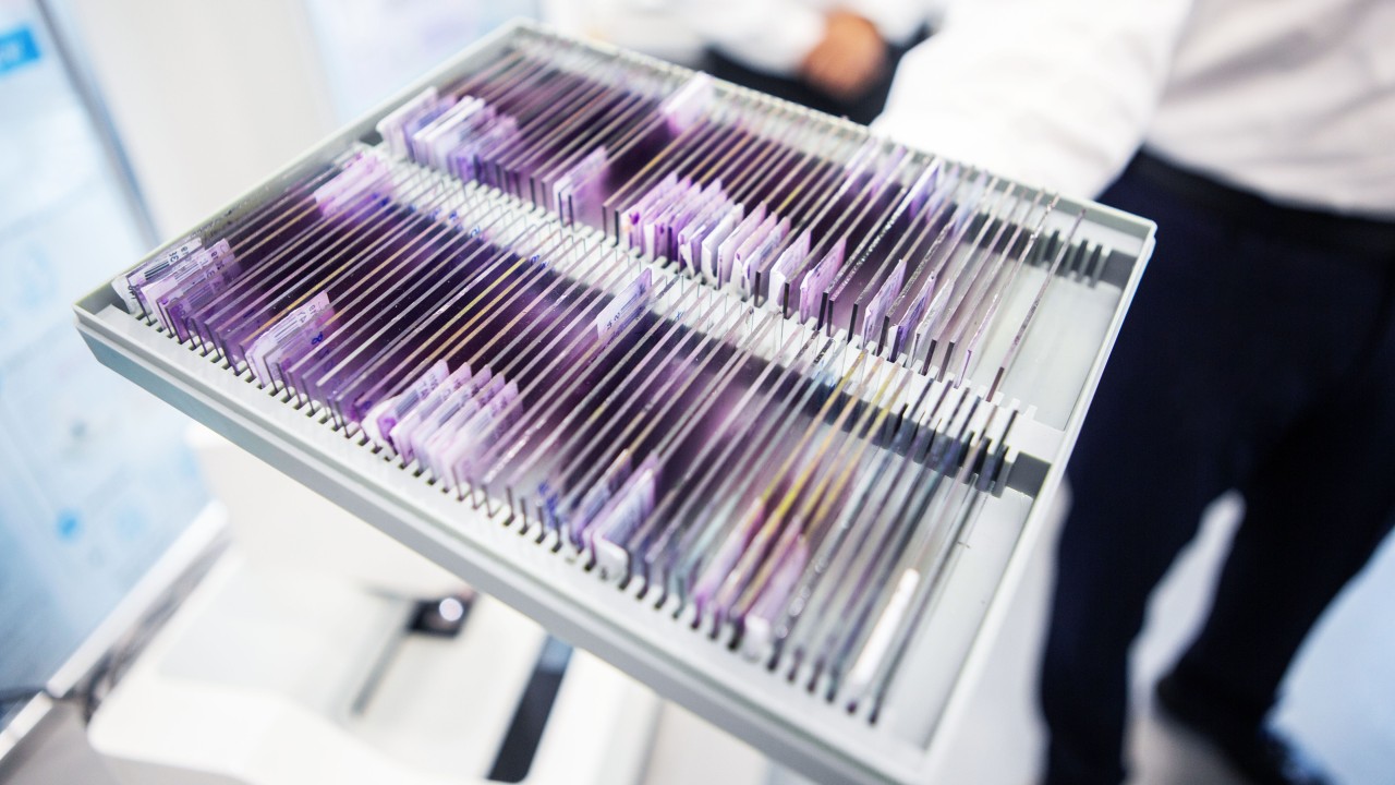 Bosch facilitates medical diagnosis with artificial intelligence ...